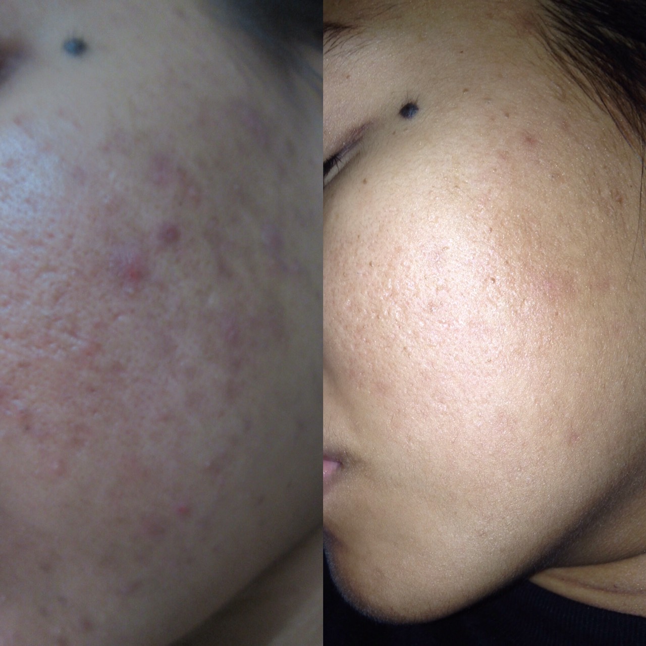 Blog Perdana: REVIEW DR. KUN JAYANATA