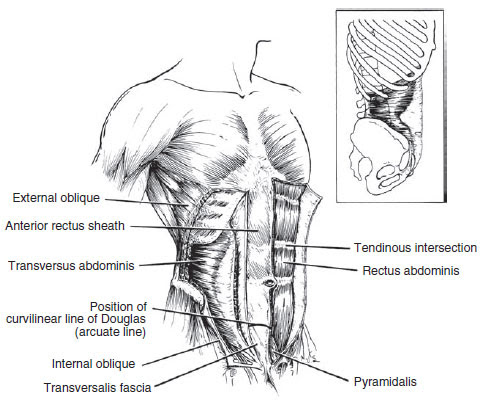 Inferior Epigastric Artery Case File