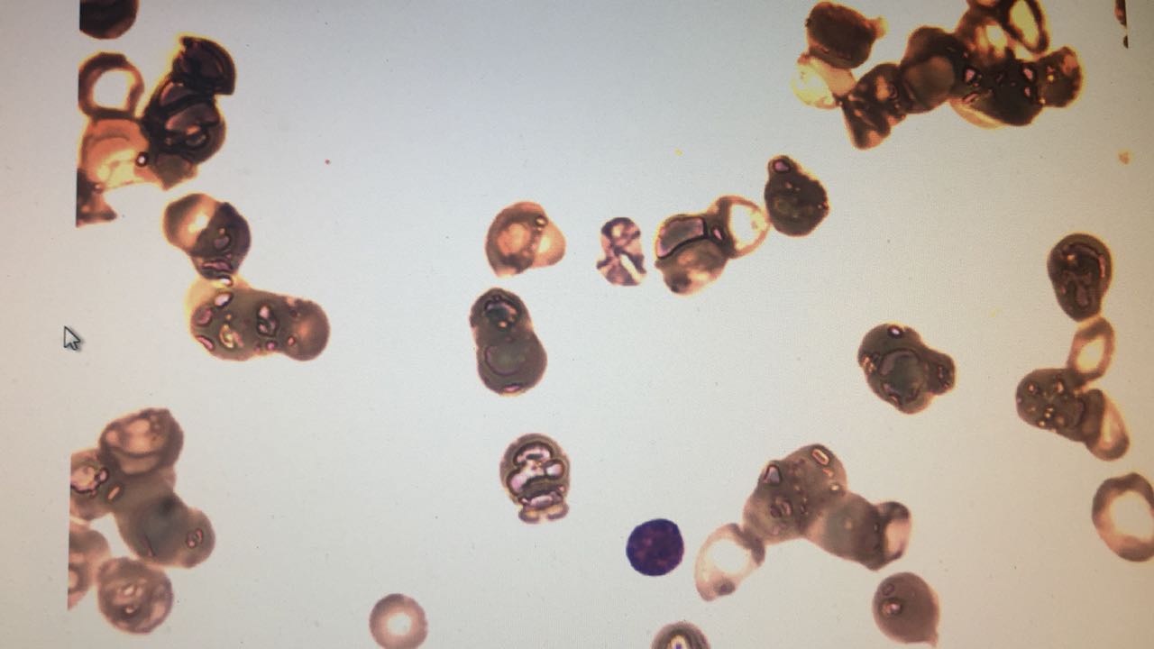 EL RINCÓN DE LA MEDICINA INTERNA. juanpedromacaluso@yahoo.com.ar: Mujer ...