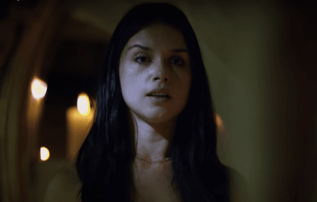 A impressionante história de Alison Botha, que ficou sem cabeça e não ...