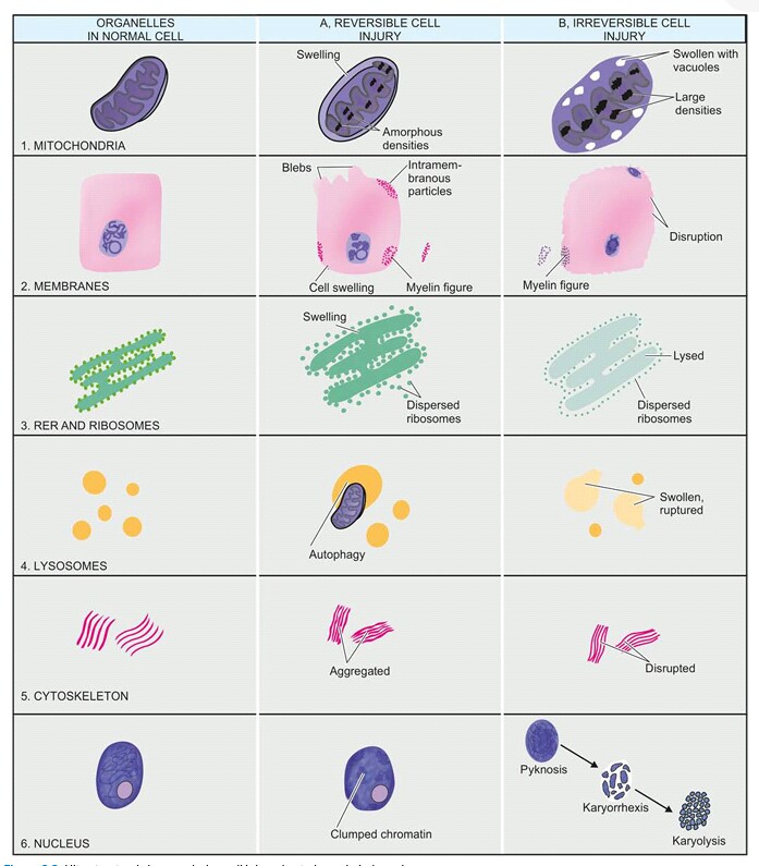 Cell injury