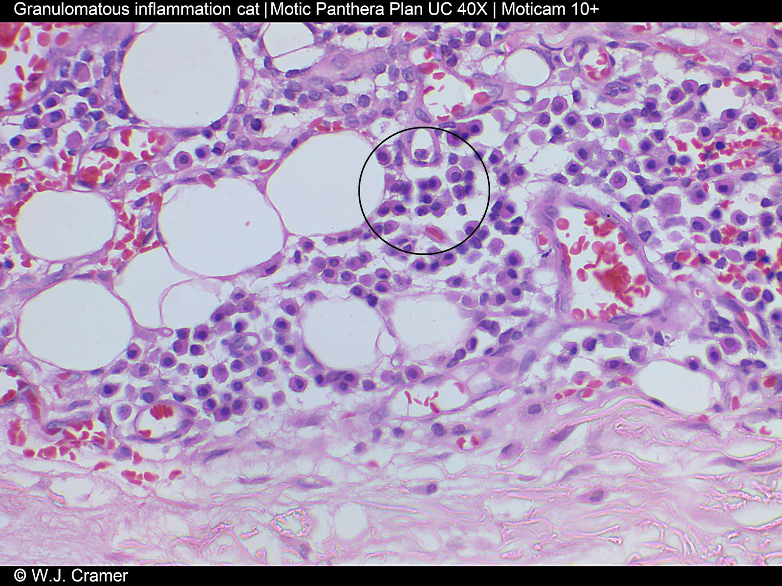 Motic Europe | Blog: Granulomatous inflammation cat