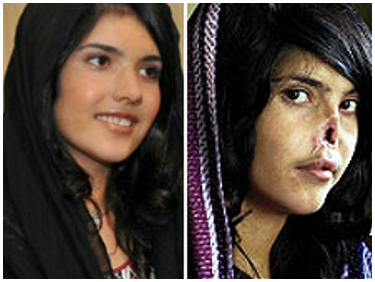 Aesha Mohammadzai Ears