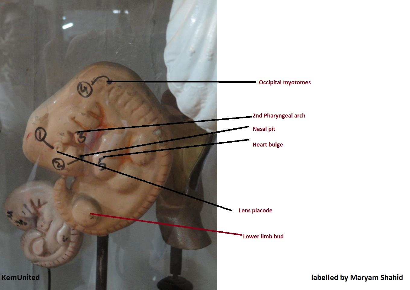 Embryology Models 2nd Year (labelled)