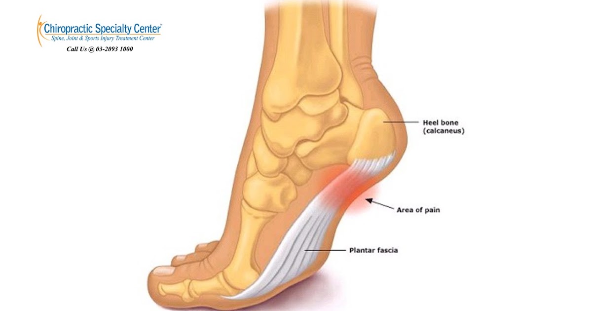 Heel Pain Heel Pain