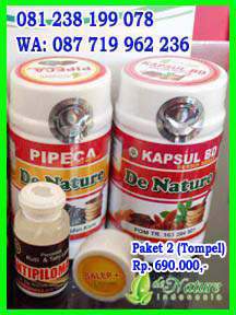 Ternyata ini penyebab timbulnya tompel