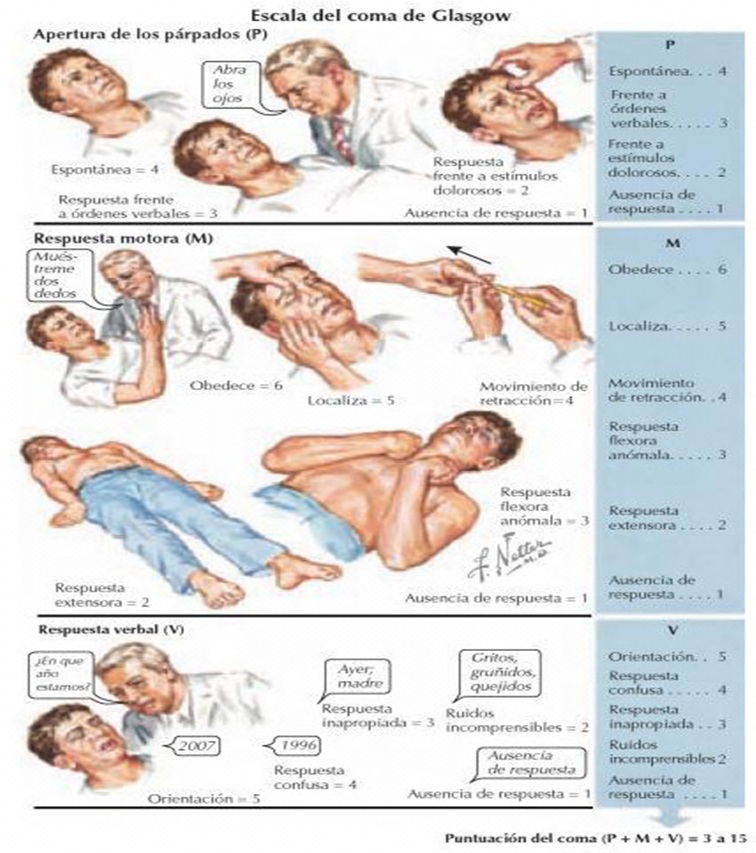 Enfermer@ en Urgencias y UCI : Valoracion de conciencia Escala AVDN ...
