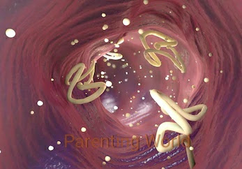 Worm infection in babies