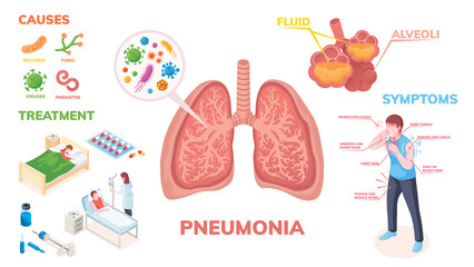 Pneumonia - Common, Yet Misunderstood Respiratory Disease.