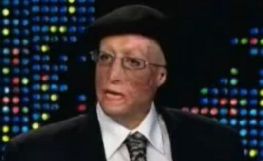 Michael is alive: Dave Dave