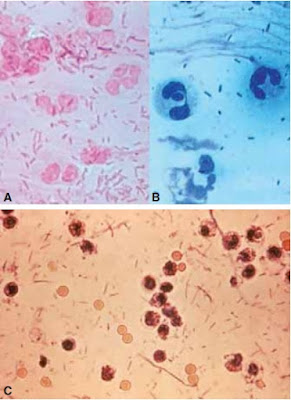 [Microbiology] Atlas of Fecal Analysis | Free Medical Atlas