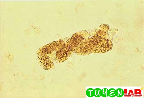 Atlas of Casts in urine | Free Medical Atlas