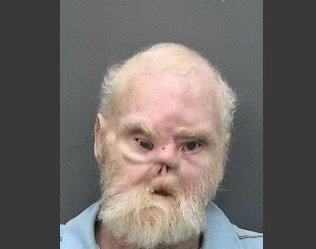 Effiong Eton Pervert Florida Man Pervert Who Once Shot Himself In