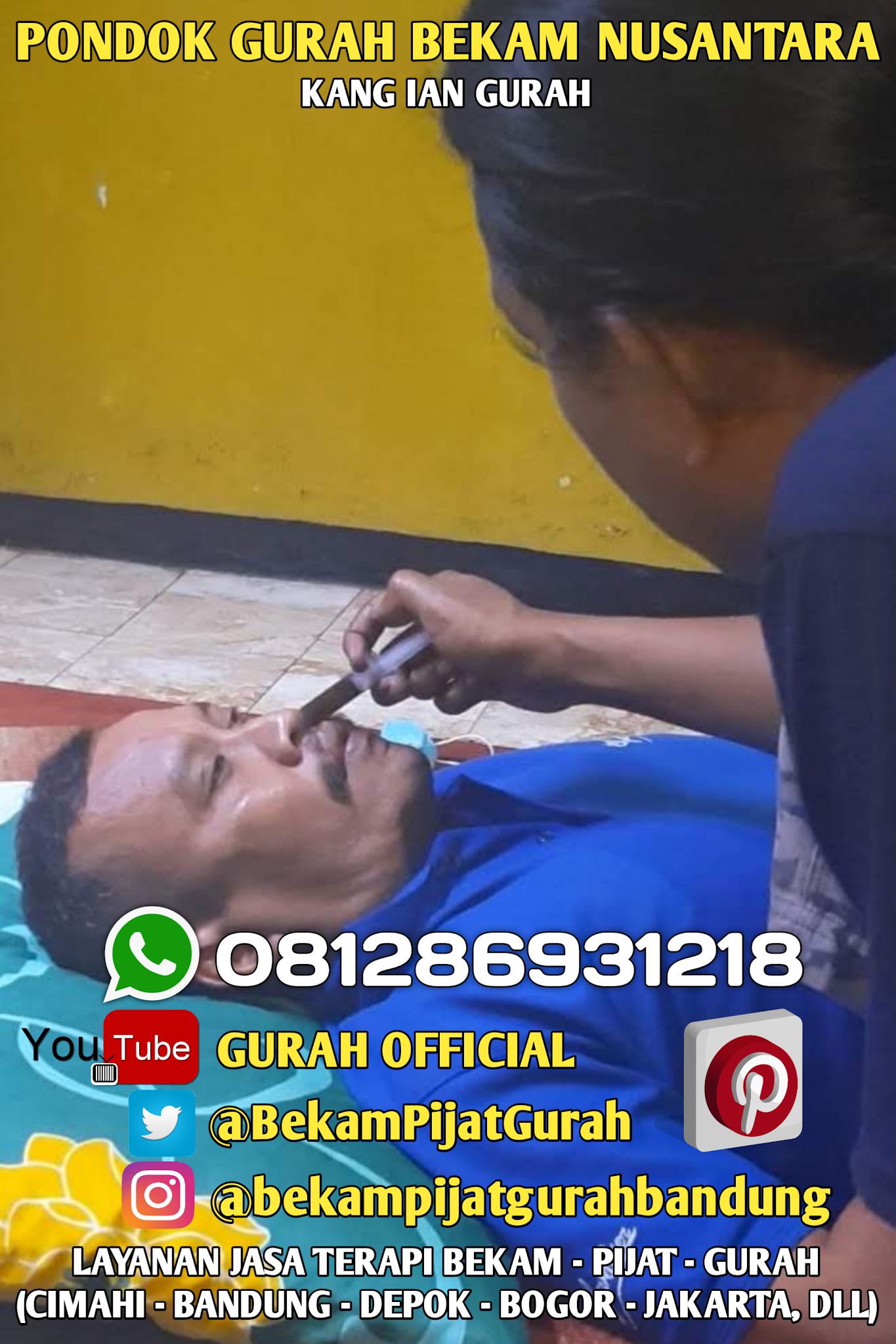 Gallery Kegiatan Proses Terapi Bekam Gurah dan Pijat