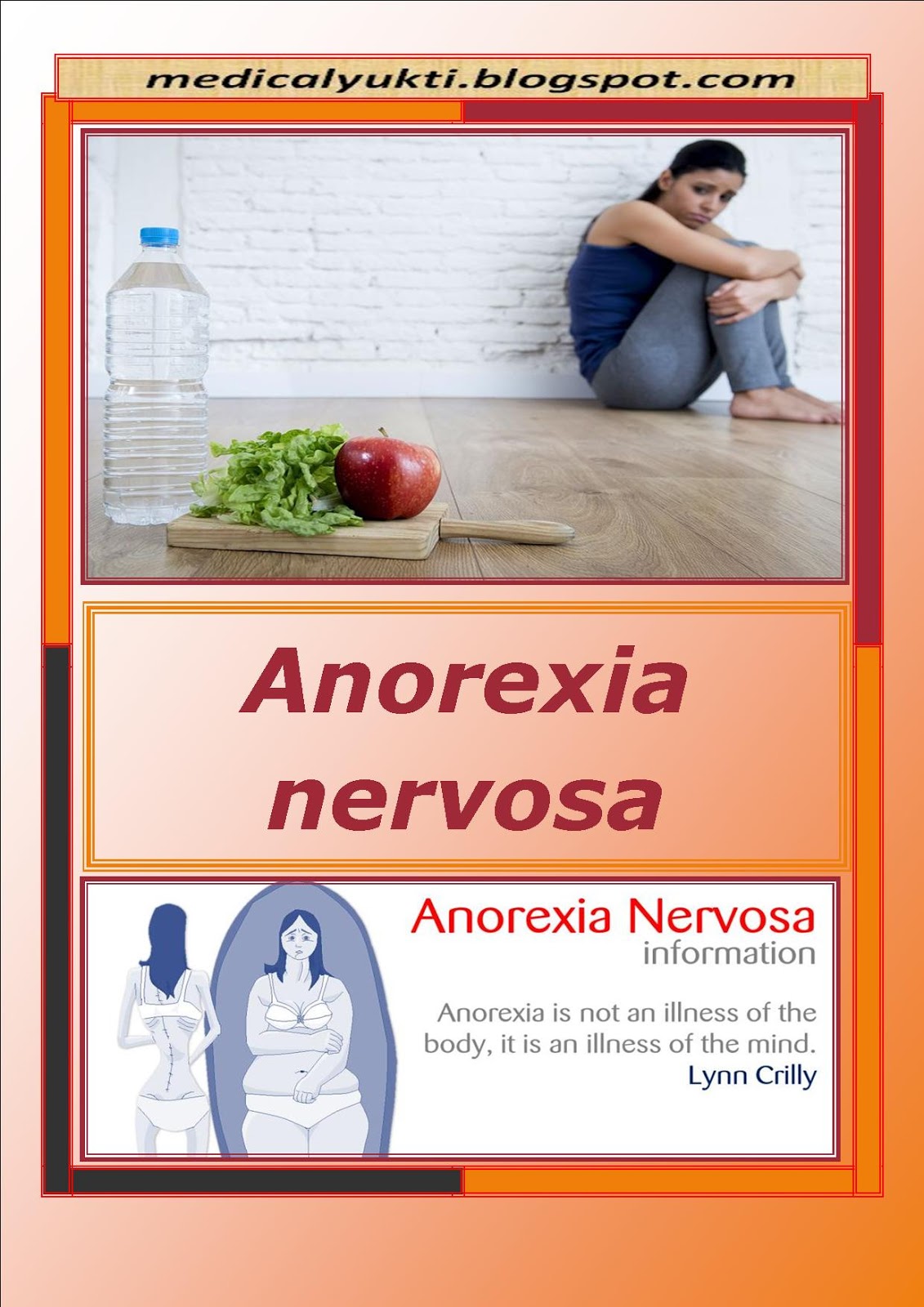Anorexia nervosa - Medical Yukti