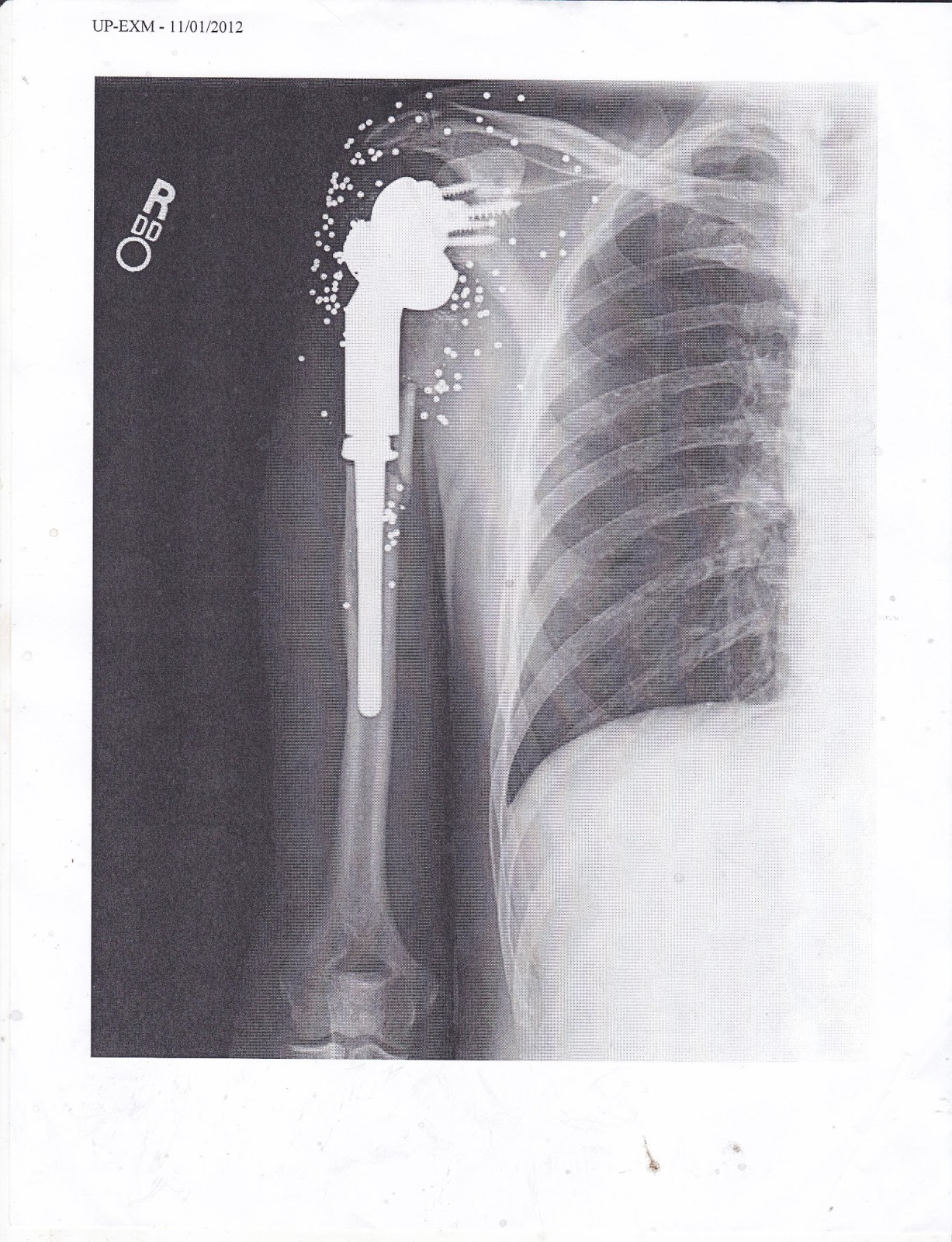 Knuckledraggin My Life Away : 12 Gauge birdshot damage