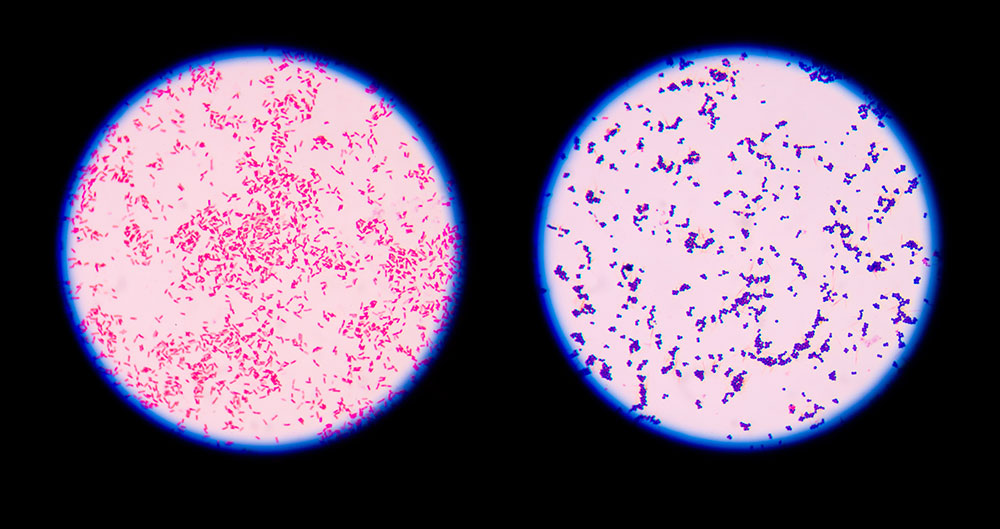 GRAM'S STAINING - PRINCIPLE , PROCEDURE,OBSERVATION
