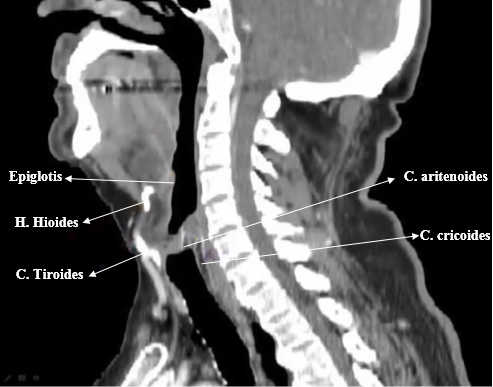 Tomografía Laringe – Centro Médico Dr. Serván