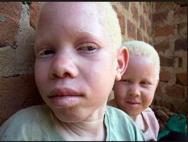 Prise en charge scolaire d’un groupe d’enfants albinos de Kananga | BA ...