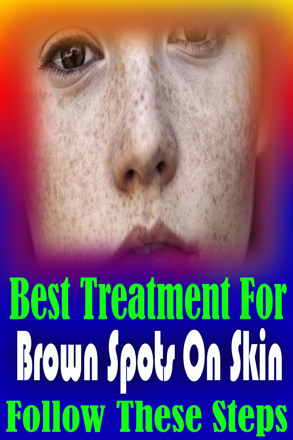 Best Treatment For Brown Spots On Skin Follow These Steps best-treatment-for-brown-spots-on-skin-follow-these-steps