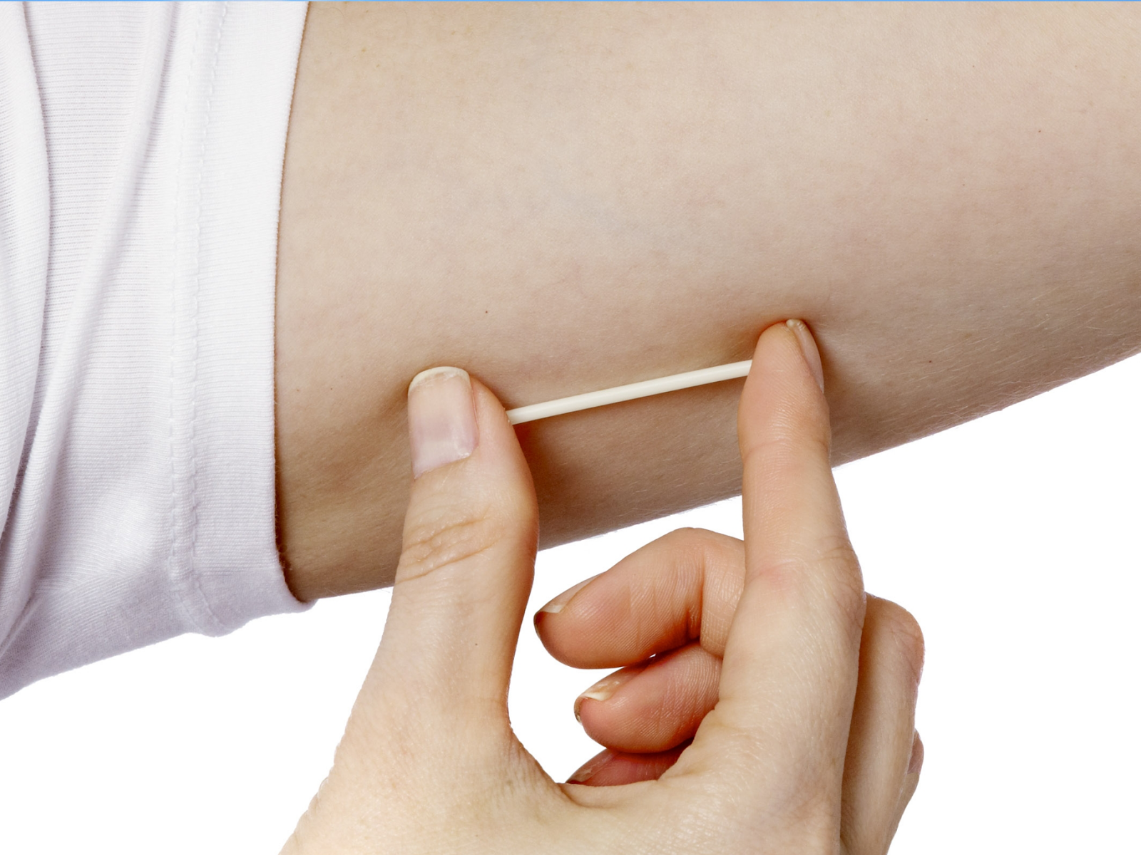 Moms Talk: KB Implant/Susuk (Implant Birth Control) - Review Pemakaian ...