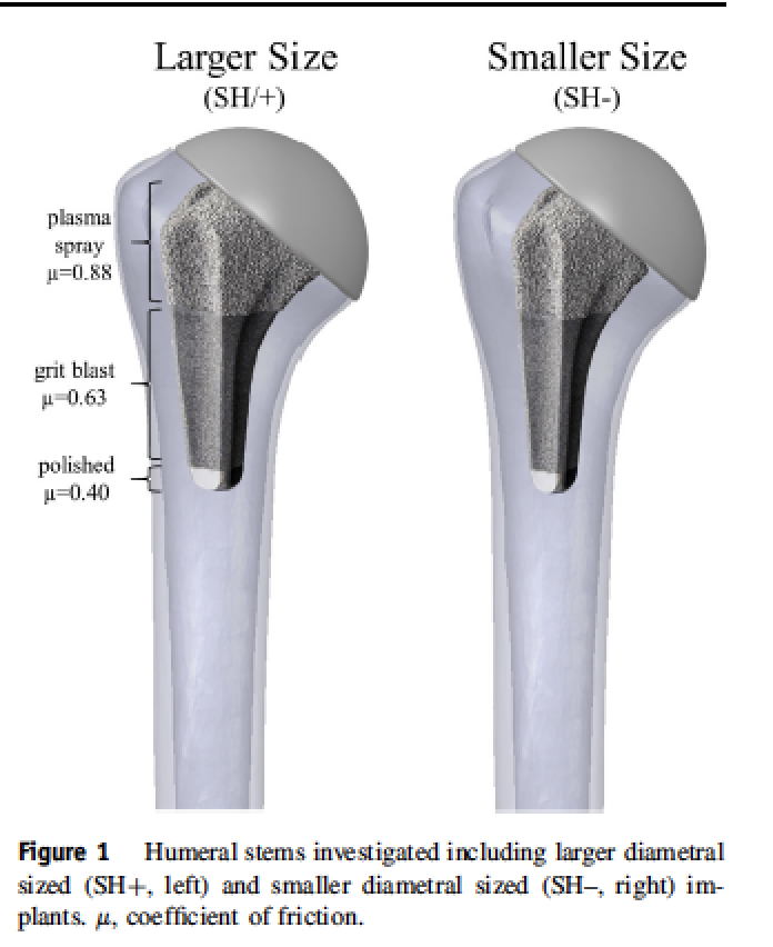 Shoulder Arthritis / Joint Replacement : Total shoulder - is a short ...
