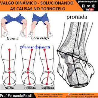 VALGO DINÂMICO – SOLUCIONANDO AS CAUSAS NO TORNOZELO!