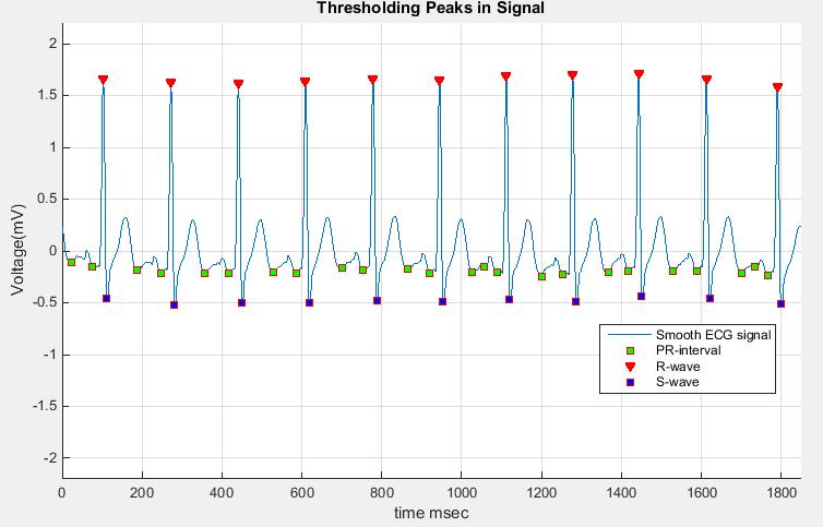 Biomedical Signal and Image Processing projects using Matlab and ...