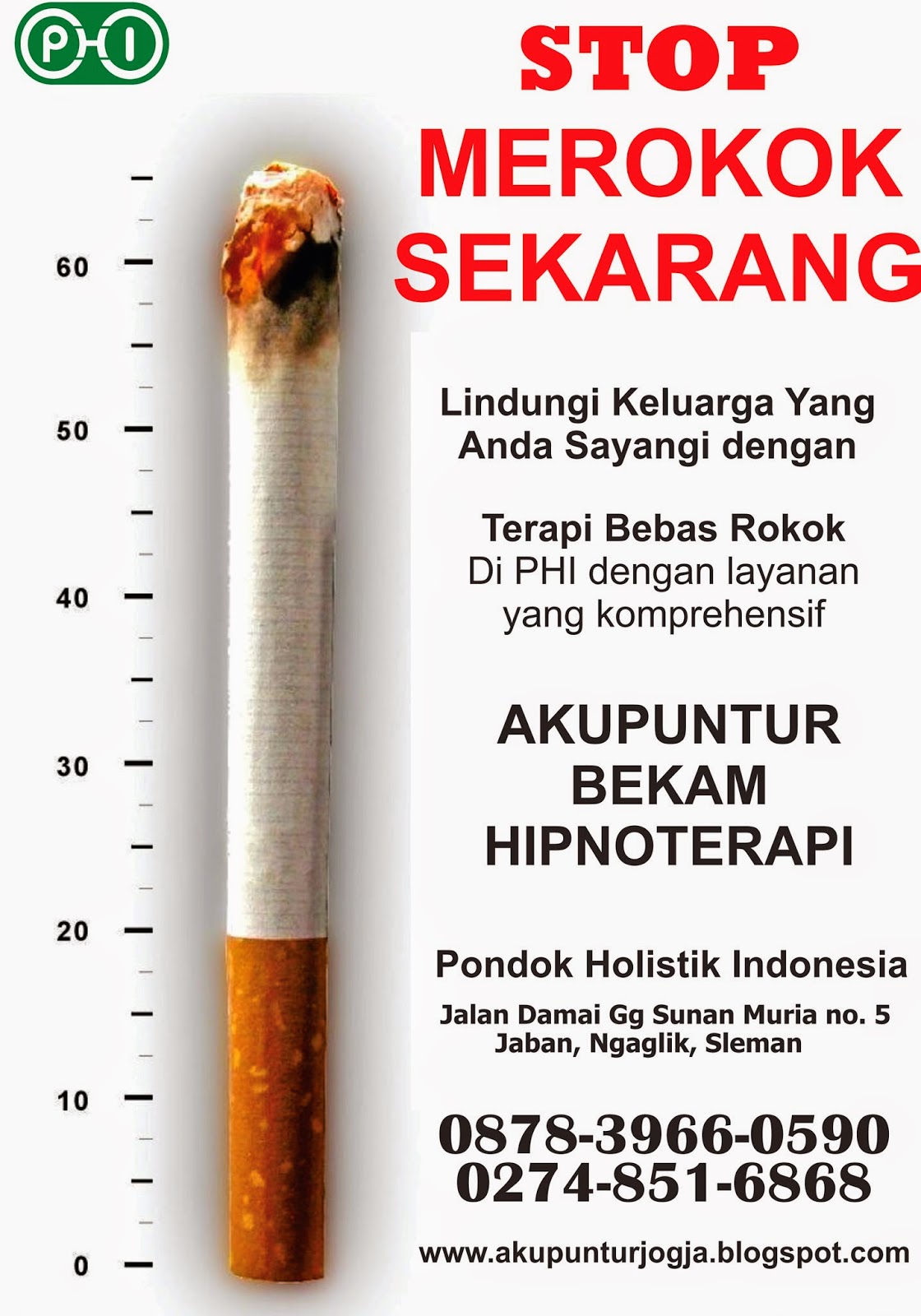 Juni 2014 ~ Klinik Akupuntur Bekam Hipnoterapi Jogja