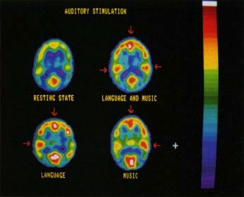 MTEC: Music Therapy Month Series: Music Therapy and Rehabilitation