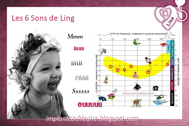 Les 6 Sons de Ling (Six Ling Sound)