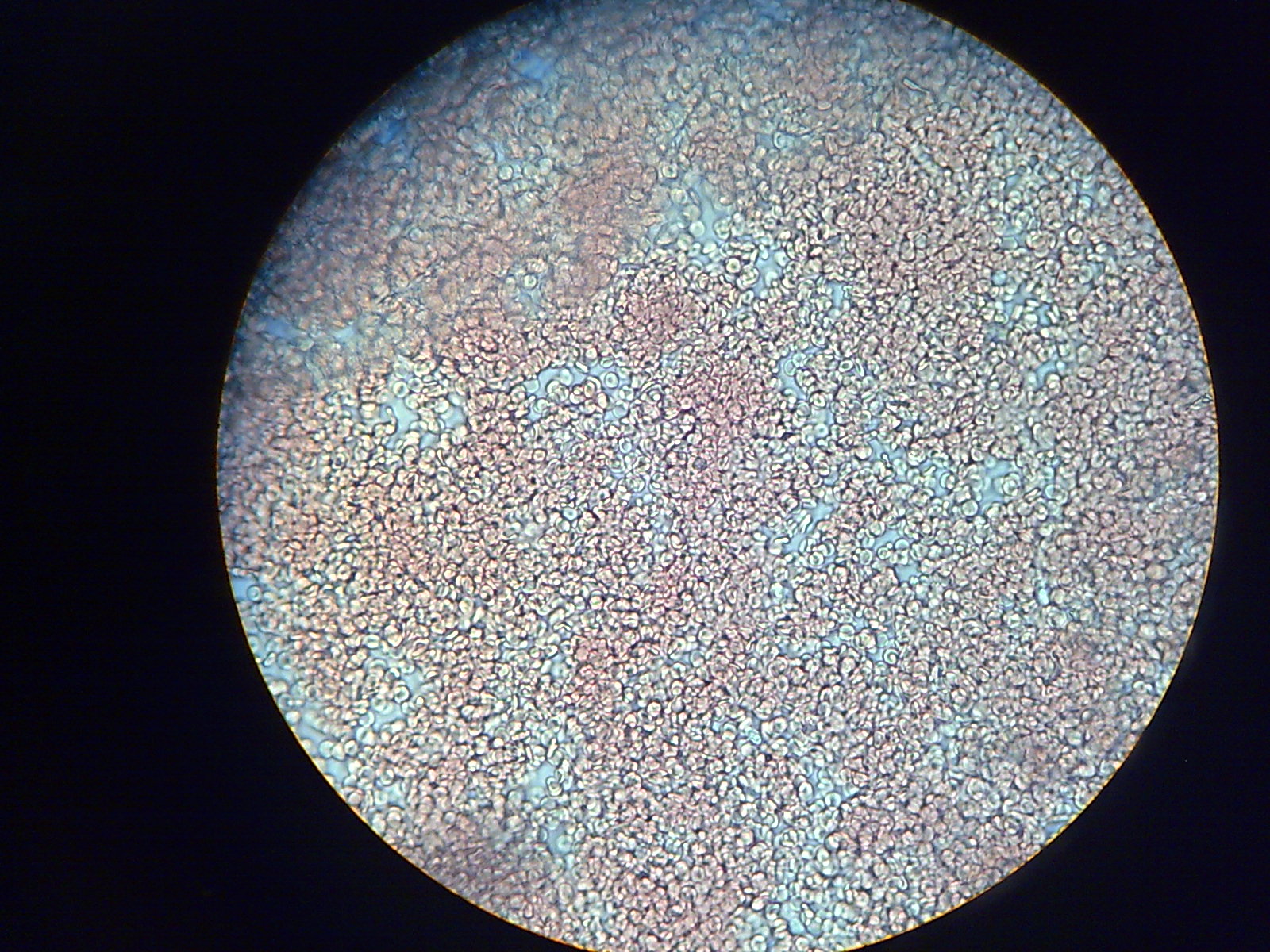 Grupo B de Microbiología de la FCQ: Actividad 2; La microscopía.