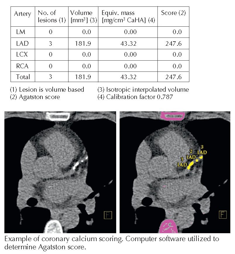 CARDIAC COMPUTED TOMOGRAPHY - pediagenosis