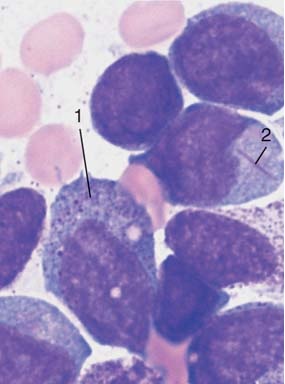 [Haematology] Abnormalities of the White Cell Series | Free Medical Atlas