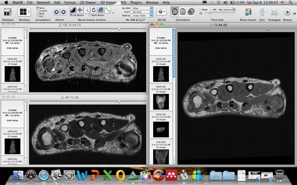 MRI and Medical Imaging: Extremities MRI scanners: exquisite, fast and ...