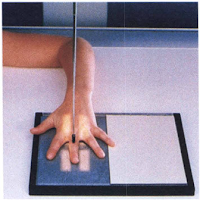 PA PROJECTION : FINGERS - Radiographic Positioning | Radiology Notes