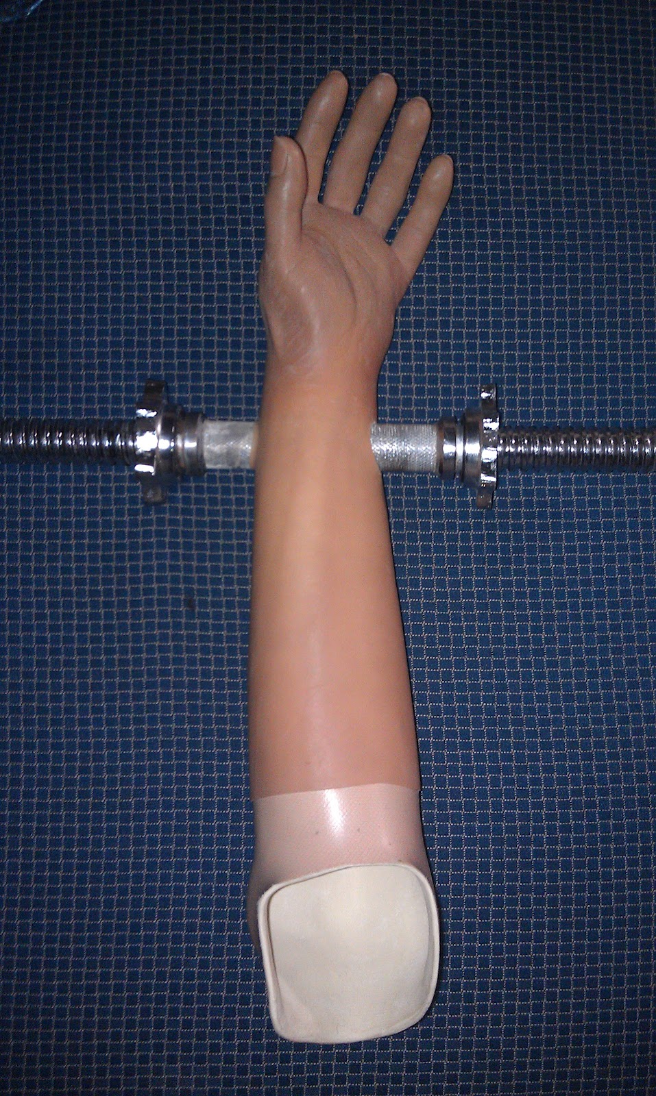 Human Assisted Prosthetic Arm for Muscle Growth
