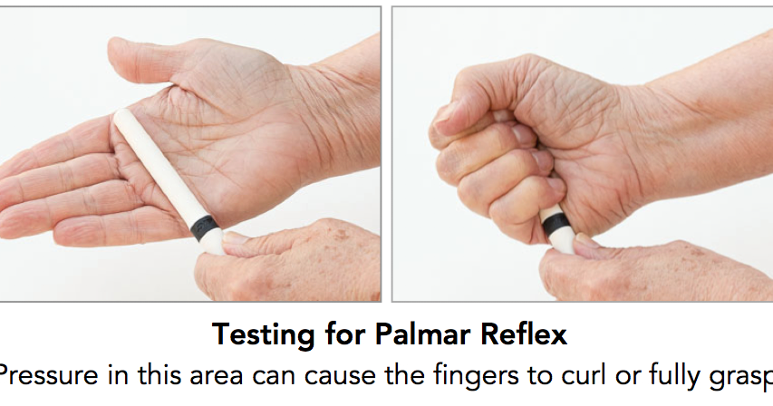 Whole-Brain Living and Learning: Understanding the Palmar (Hand) Reflex ...
