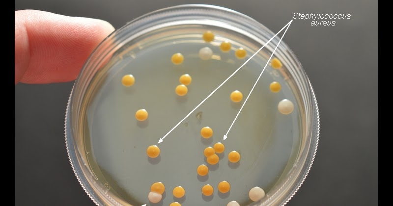 Merlins Micro World: Staphylococcus aureus - morphology, cultural ...
