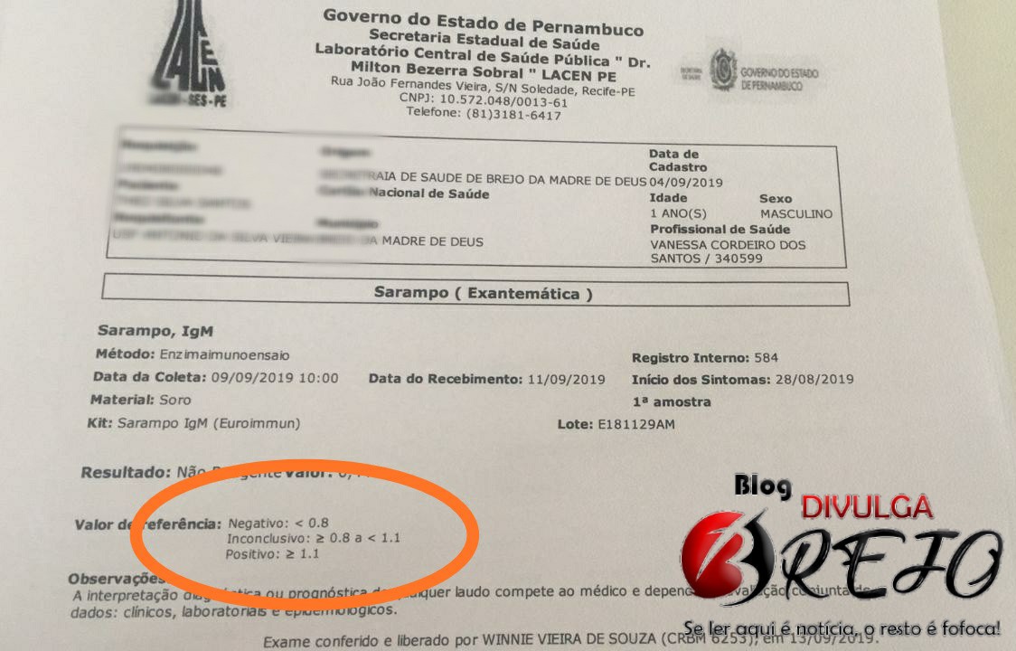 Blog Divulga Brejo - Notícias : Suspeito caso de Sarampo no Brejo ... Blog Divulga Brejo - Notícias : Suspeito caso de Sarampo no Brejo ...
