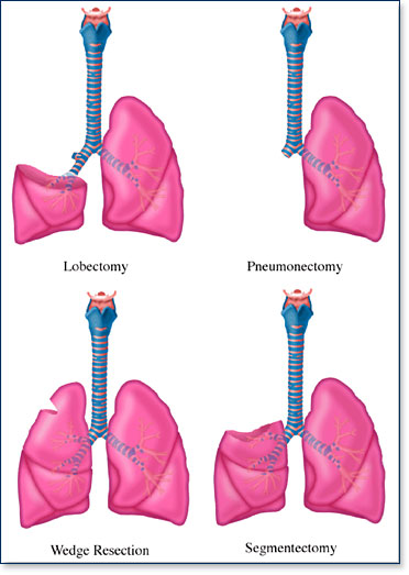 Diposting oleh faganteng di 03.06