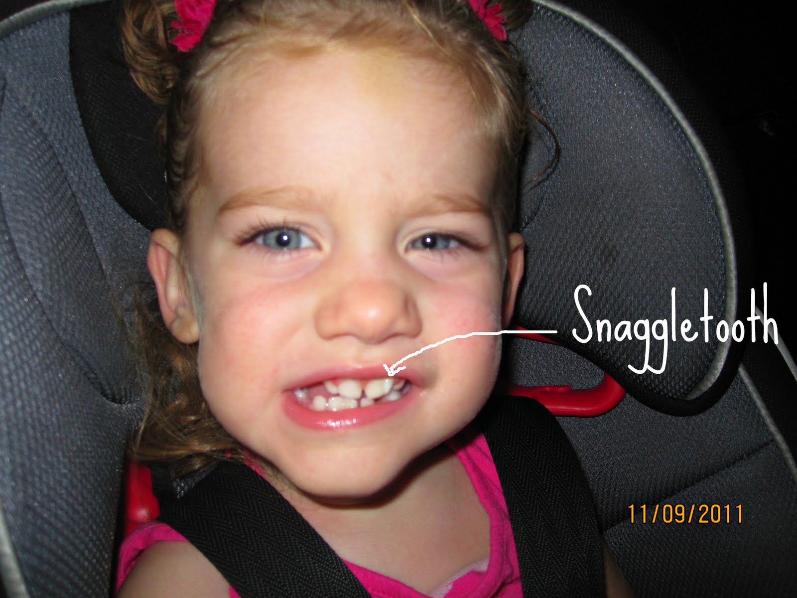 McArthur: Snaggletooth