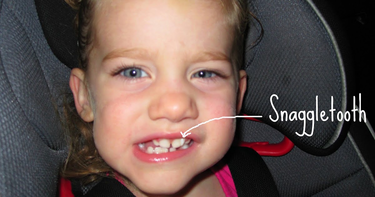 McArthur: Snaggletooth