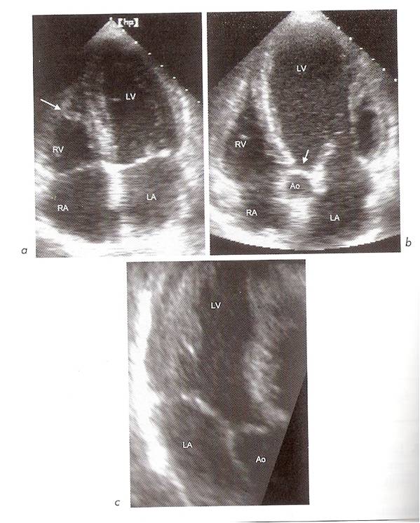 CVT Mohd Farid: Basic Echo Window :Apical View