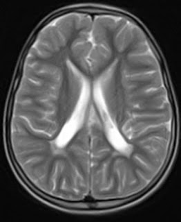 The Third Eye - Radiology site: January 2012