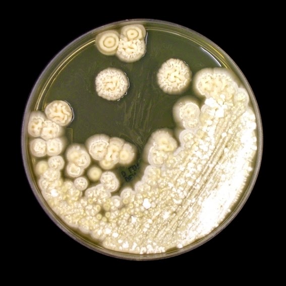 Fun With Microbiology (What's Buggin' You?): Trichosporon species