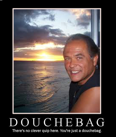 Dinar Douchebags: Douchie for July 29 - August 4