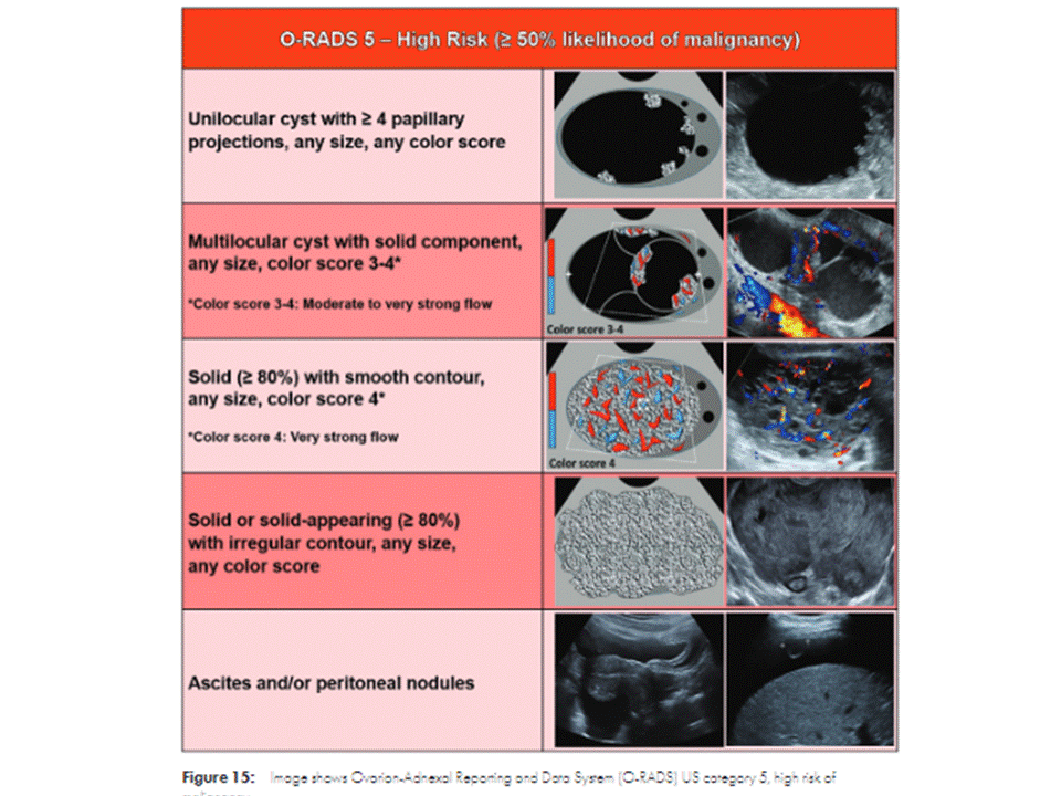 BÀI SOẠN VỀ SIÊU ÂM CHẨN ĐOÁN: O-RADS US