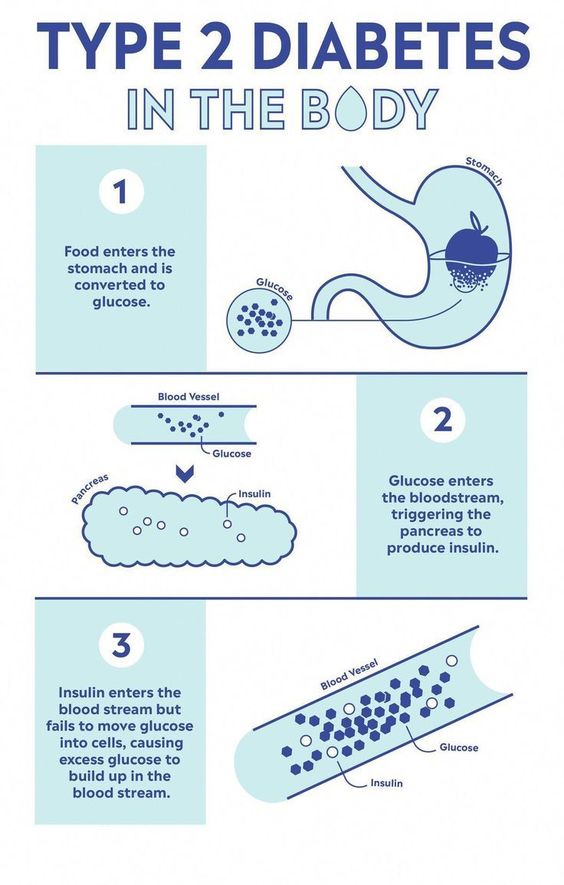 Diabetes Type 2 Facts High Blood Sugar Level Of 500 diabetes-type-2-facts-high-blood-sugar-level-of-500
