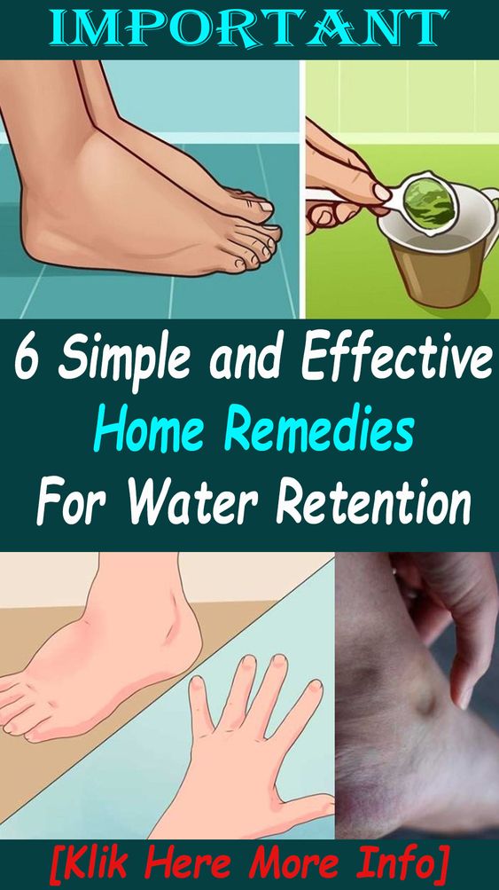 6 Simple and Effective Home Remedies For Water Retention - Health Woman